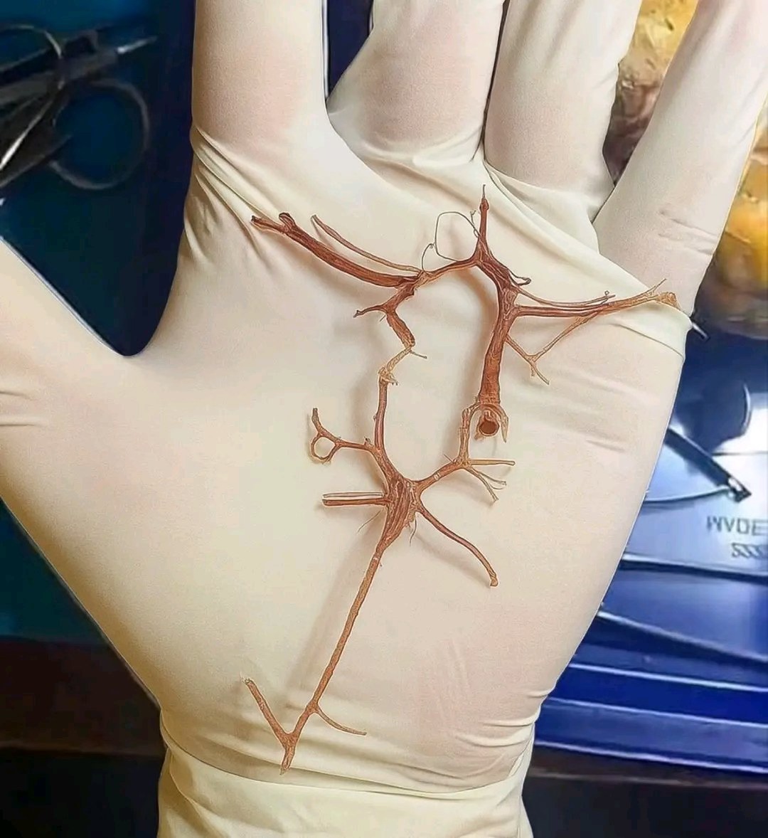 Elfér a tenyeredben, és már megmentette az életed.. Az agy@dban ...